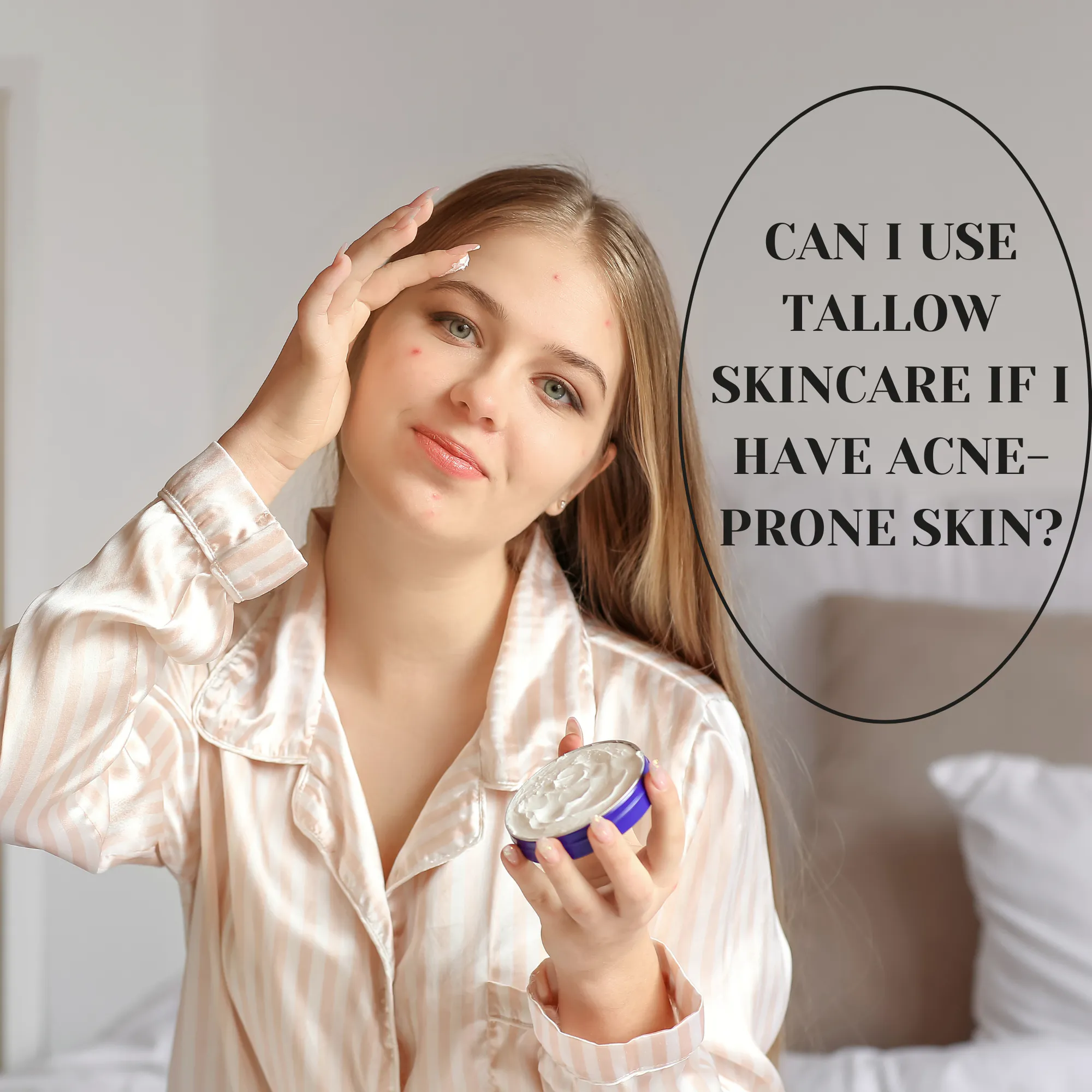 Tallow & acne-prone skin